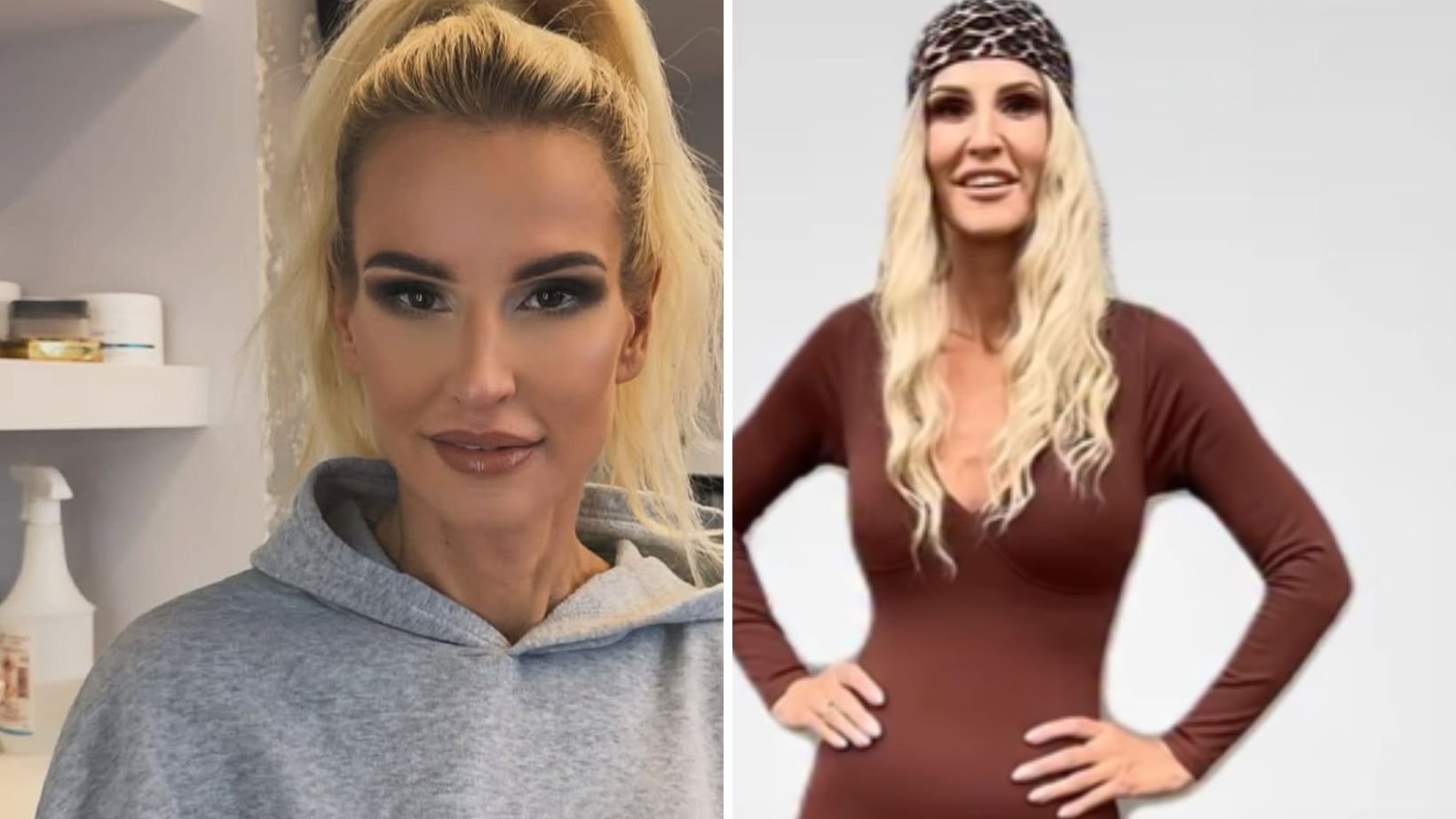 Dominika Tajner przeszła abdominoplastykę. Pokazała brzuch trzy ...