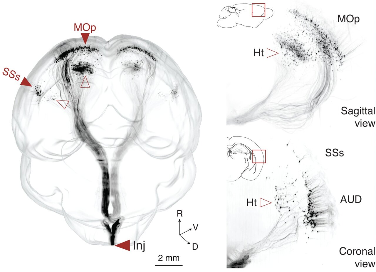 Neuron position found less crucial for brain connectivity than once thought