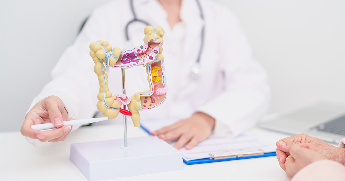 Explainer: What is diverticulitis?