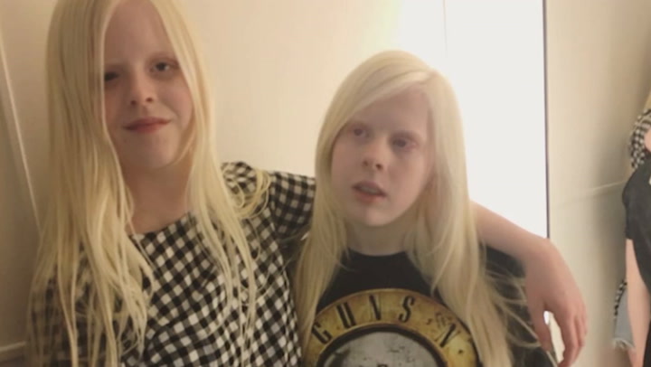 P249930YT BD AlbinismComp Youtube H264