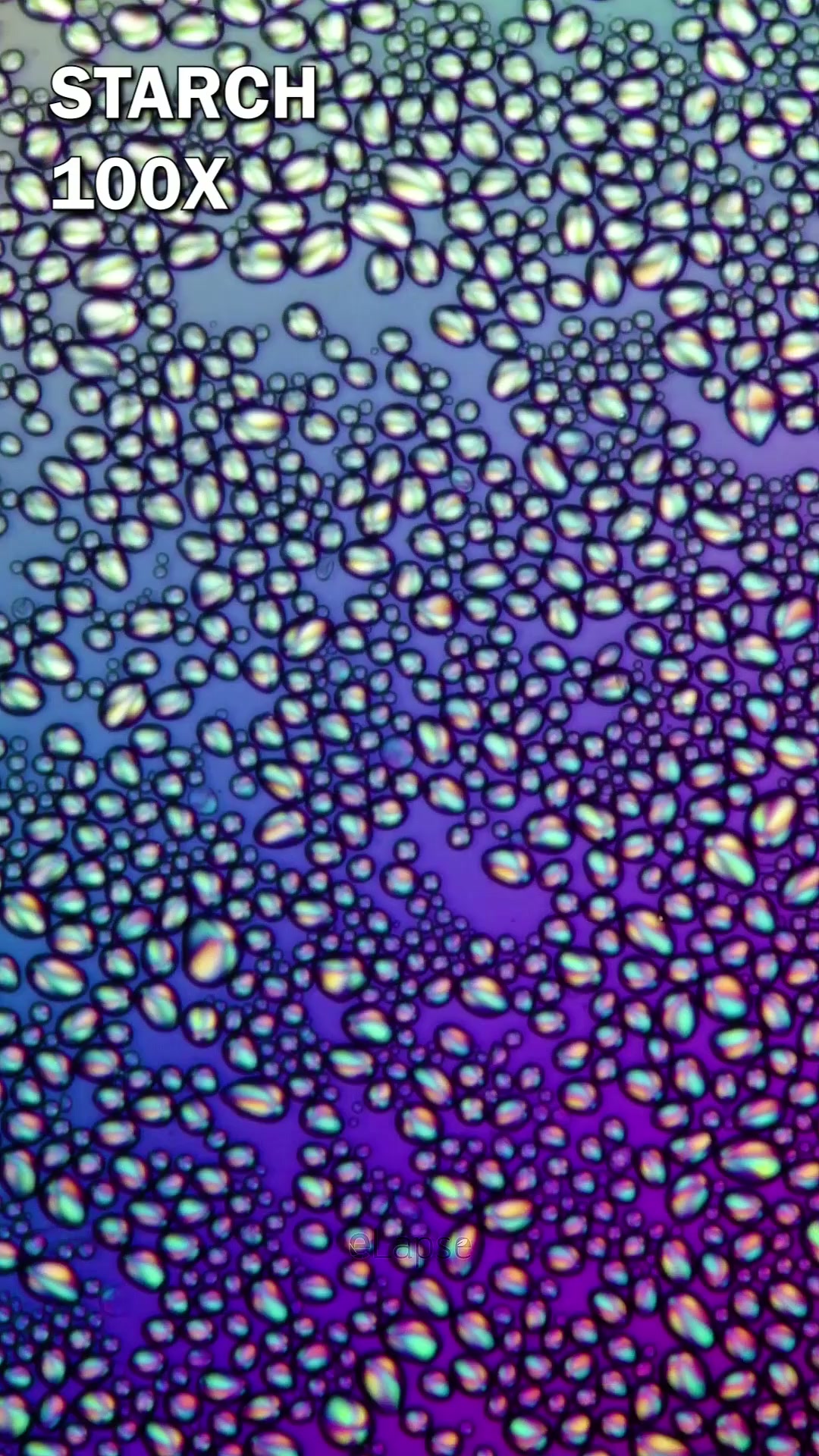 Potato under microscope