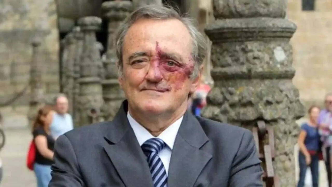 Spanish scientist finds cure for pancreatic cancer in major medical ...