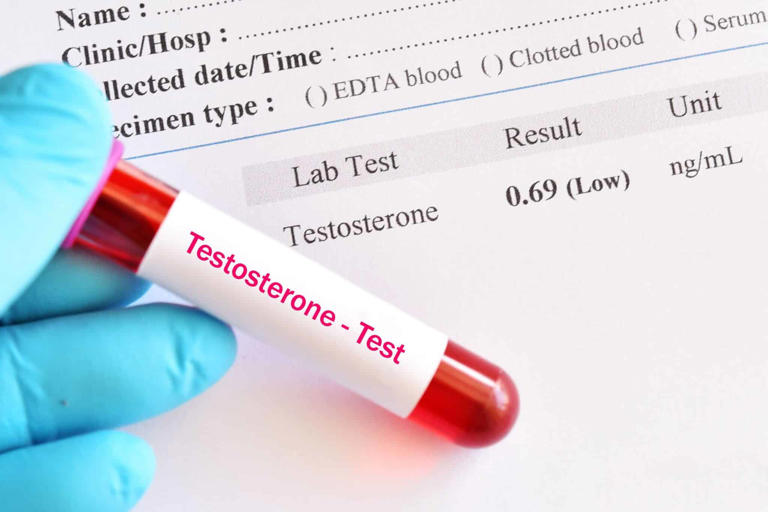 What most men don’t know about testosterone (but probably should)
