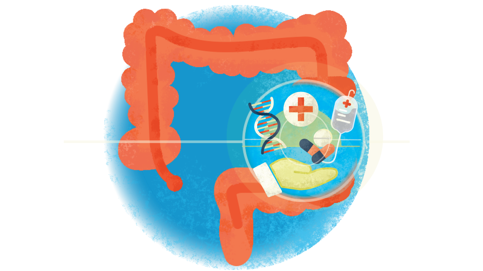 For your patients: A look at promising new treatments for gastric cancer