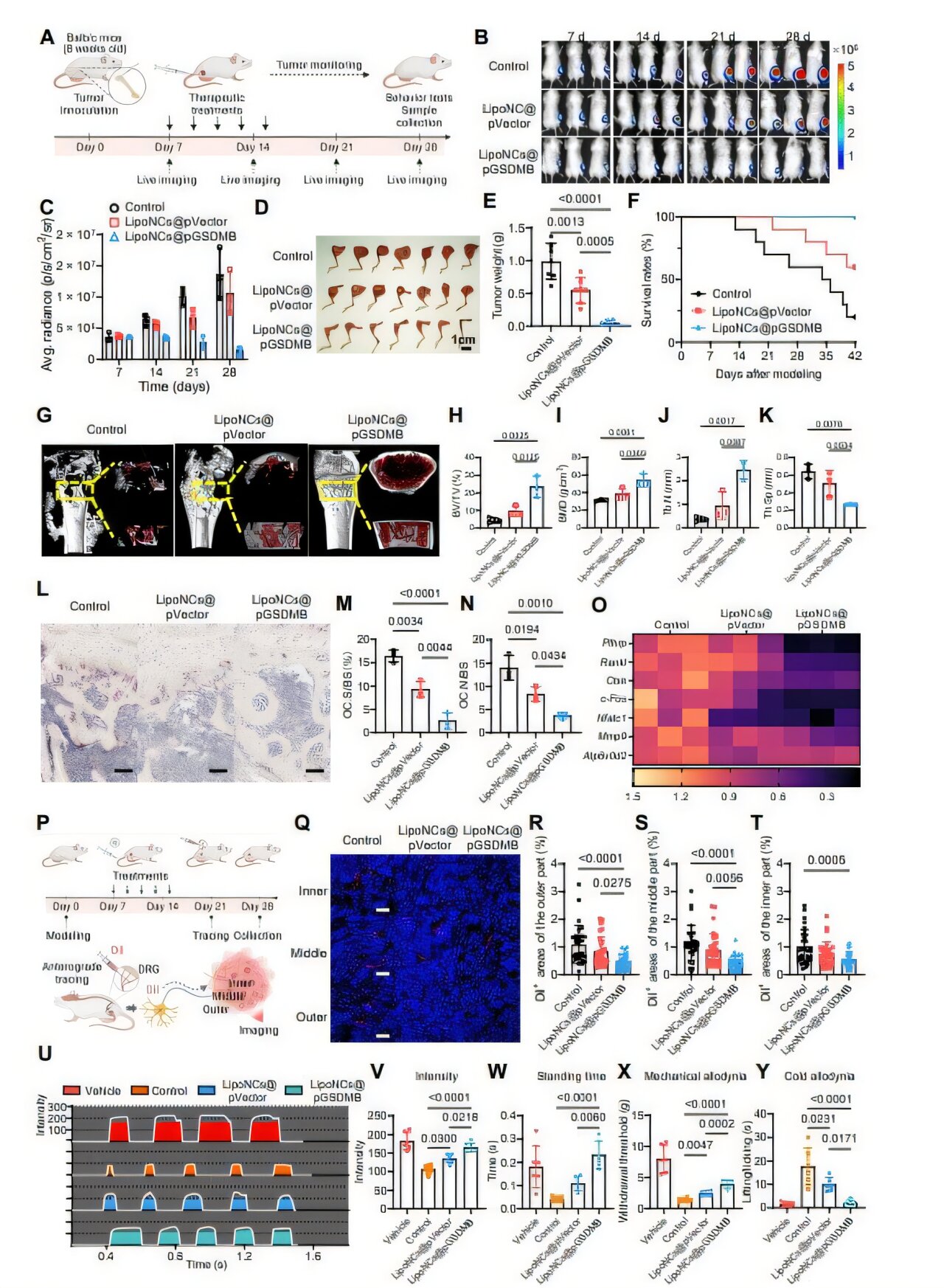 New nanotherapy eases bone metastasis pain by disrupting tumor-nerve ...