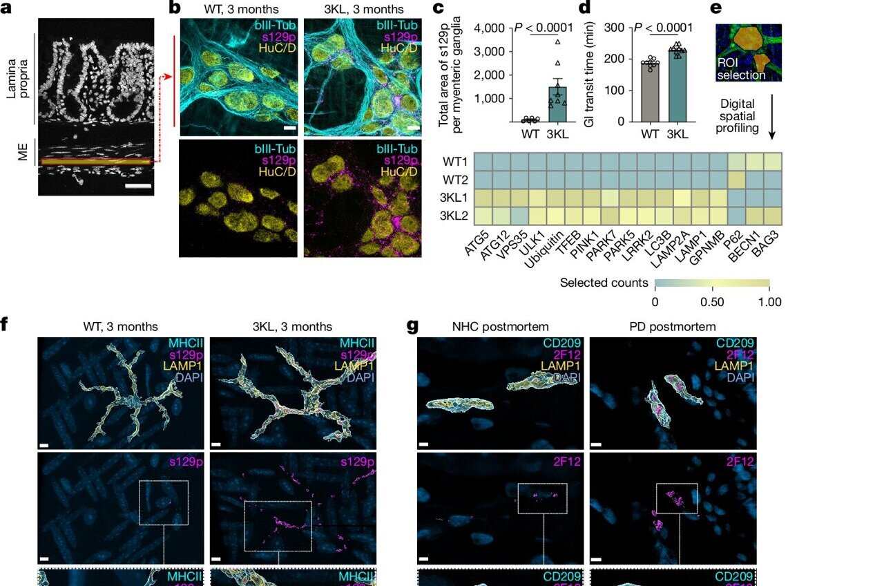Targeting the gut's immune system could tackle early stages of Parkinson's