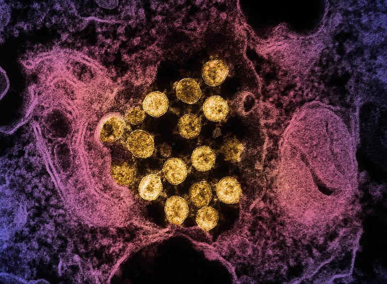 Covid could trigger new allergies years after infection with risk ...