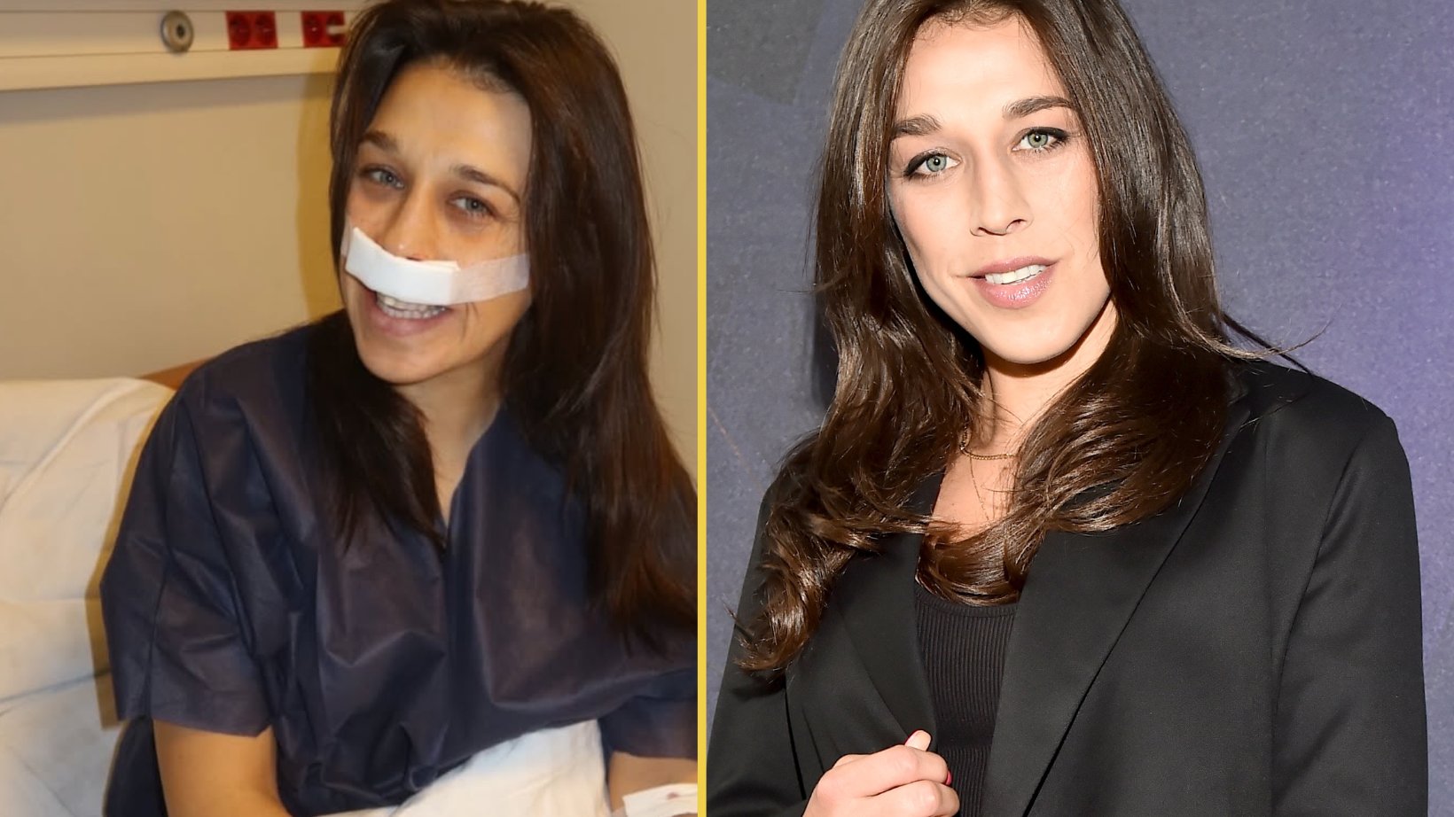 Joanna Jędrzejczyk przeszła operację. Mówi, czego się obawiała najbardziej