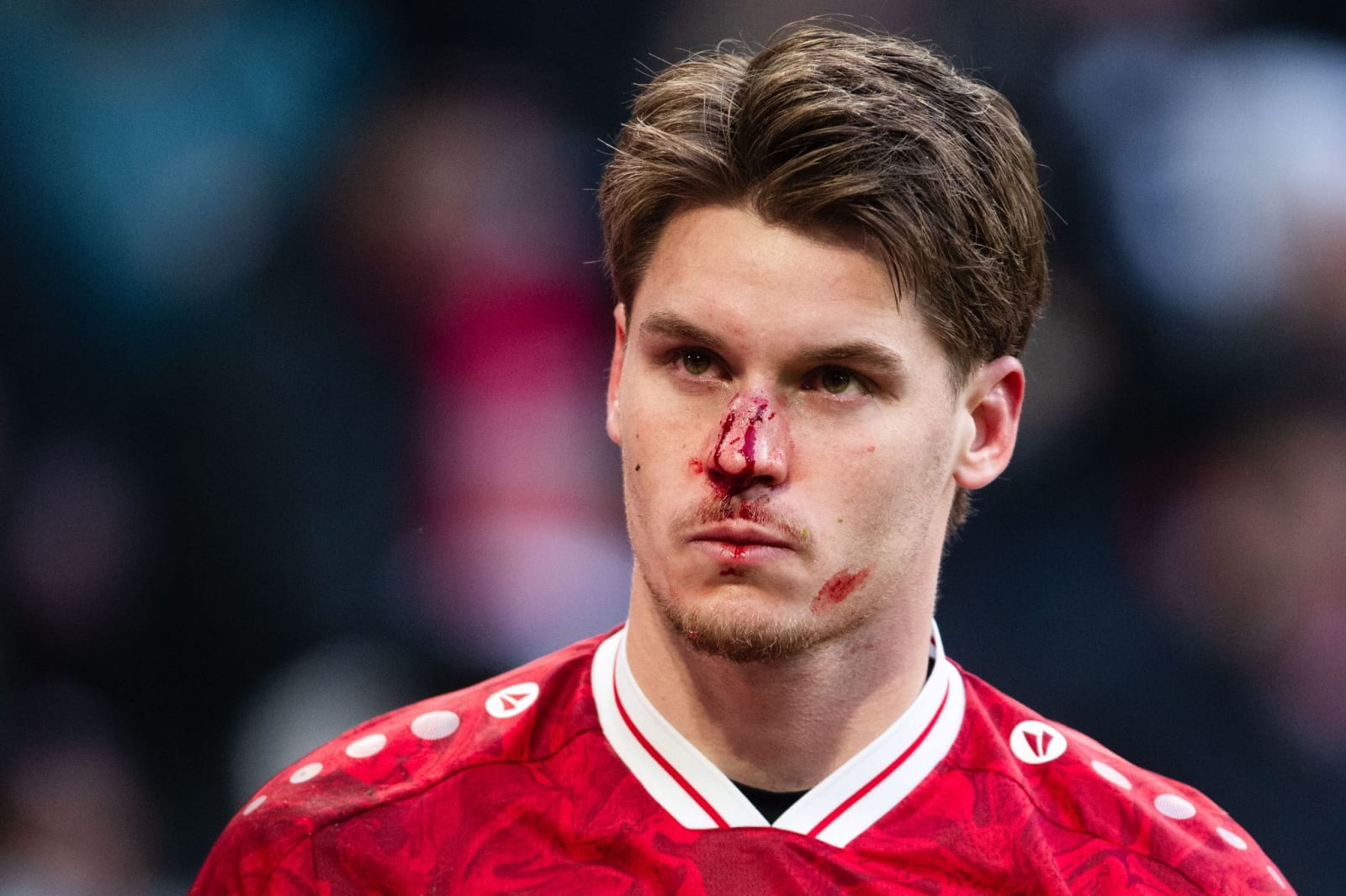 Stuttgart's Hendriks fit to face Young Boys despite broken nose