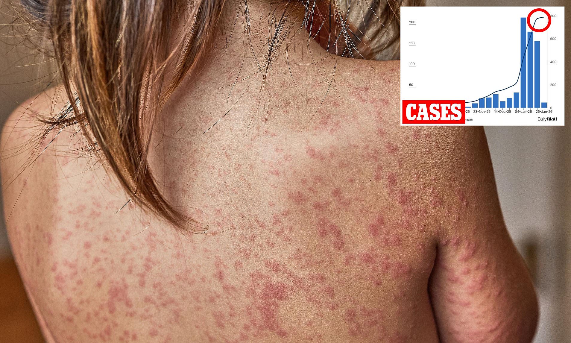 Measles crisis grips the South as biggest outbreak since elimination ...