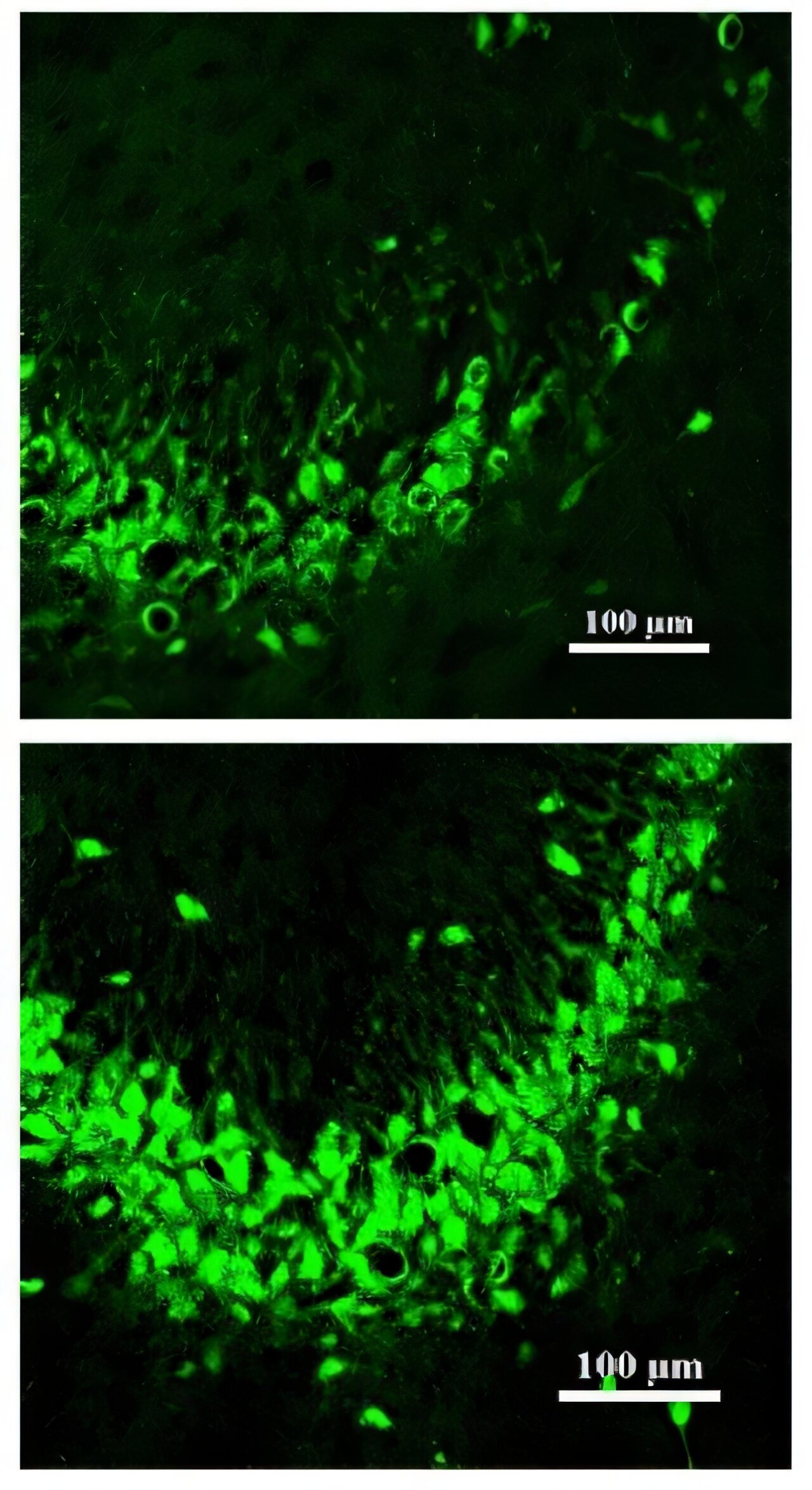 Tiny peptide shows promise in slowing epilepsy progression