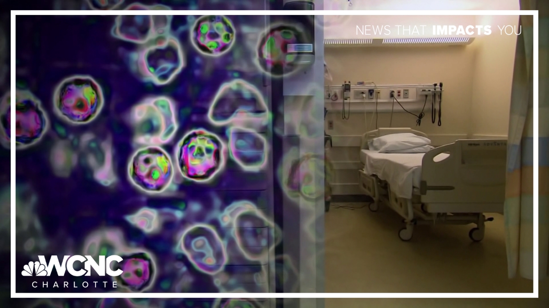 South Carolina now leads nation in measles cases