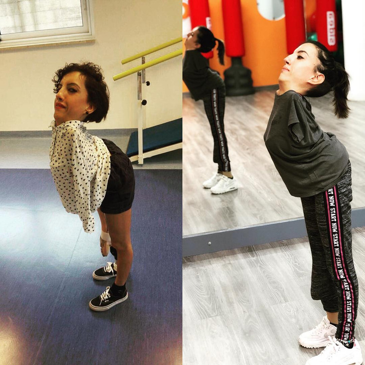 She was born without arms and a leg — now she’s inspiring millions