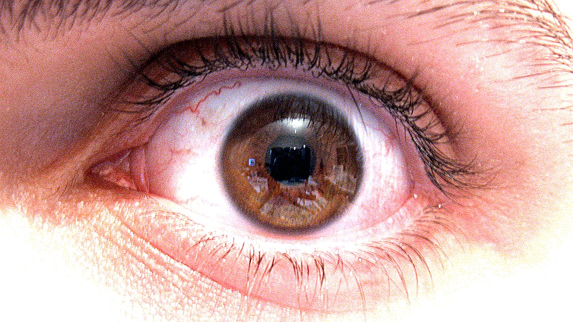 Descubren el patrón genético de la manía, clave para dar con nuevos ...