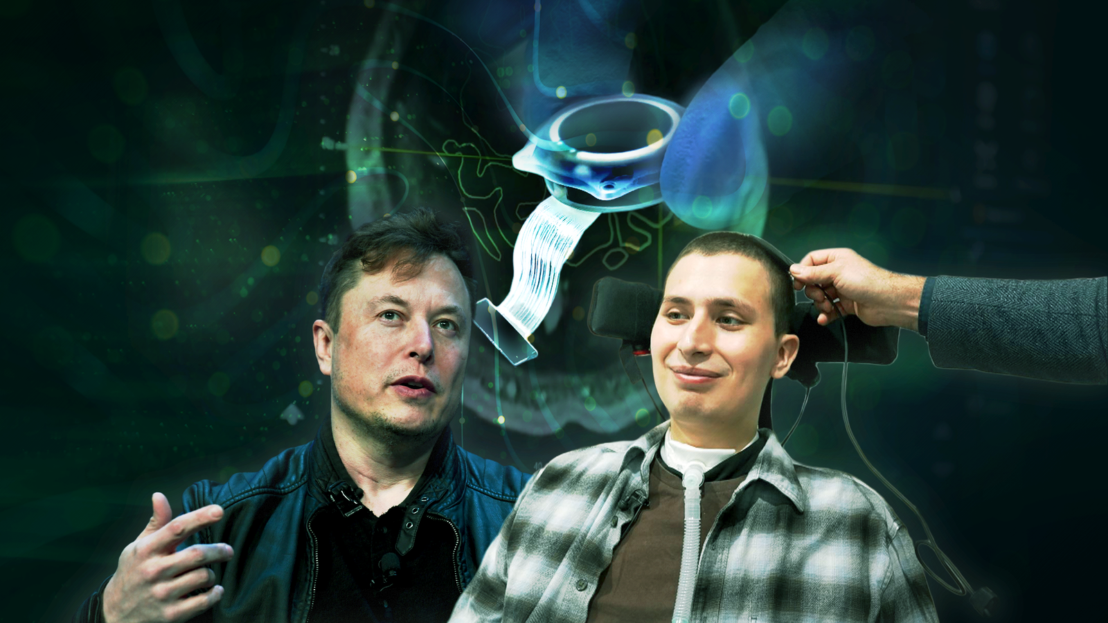 What it's like to trial Musk's brain chip