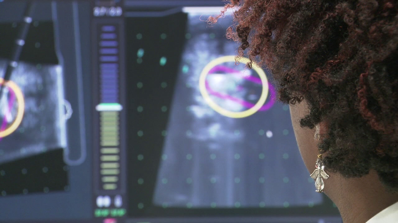 State law creating uterine fibroid research database not implemented 4 ...