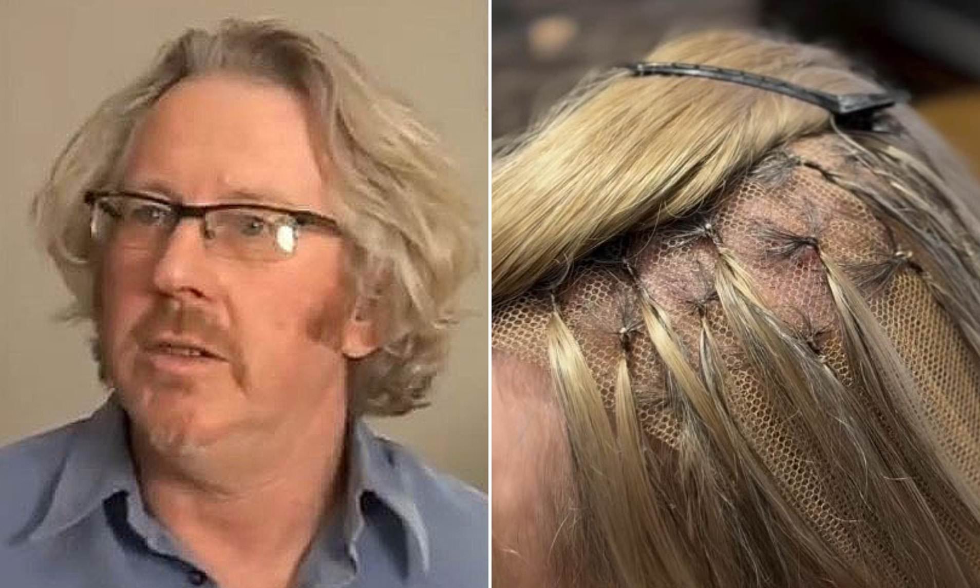 Judge rules female baldness is a 'disability' after wigmaker takes HMRC ...