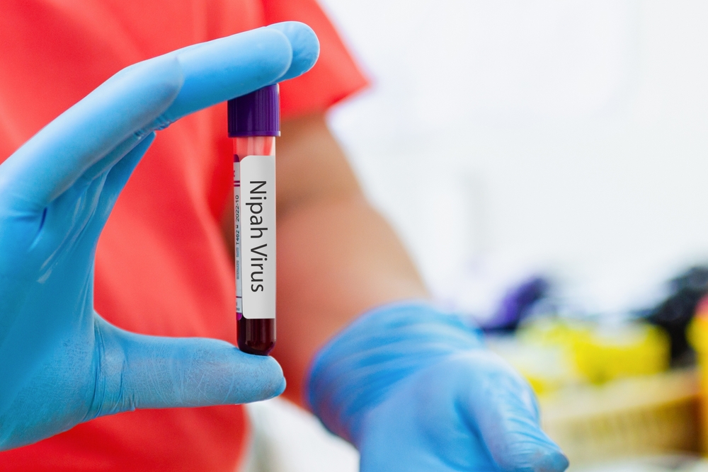 WHO confirms fatal Nipah case outside India