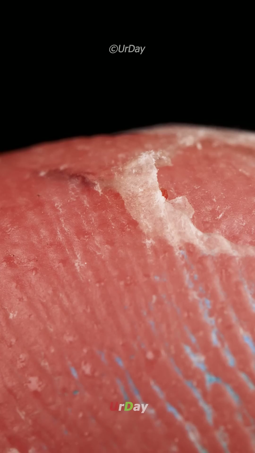 Finger splinter pulling out close-up #satisfying #urday #asmr