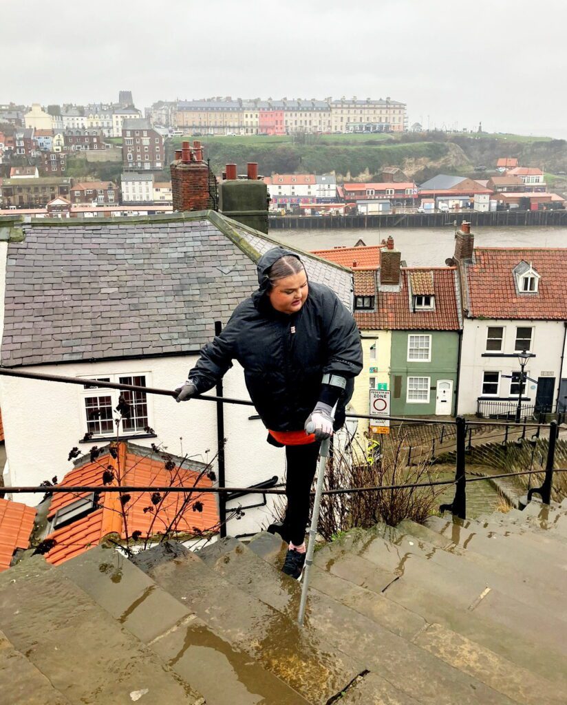 Woman who lost leg in tractor crash conquers Whitby’s 199 steps