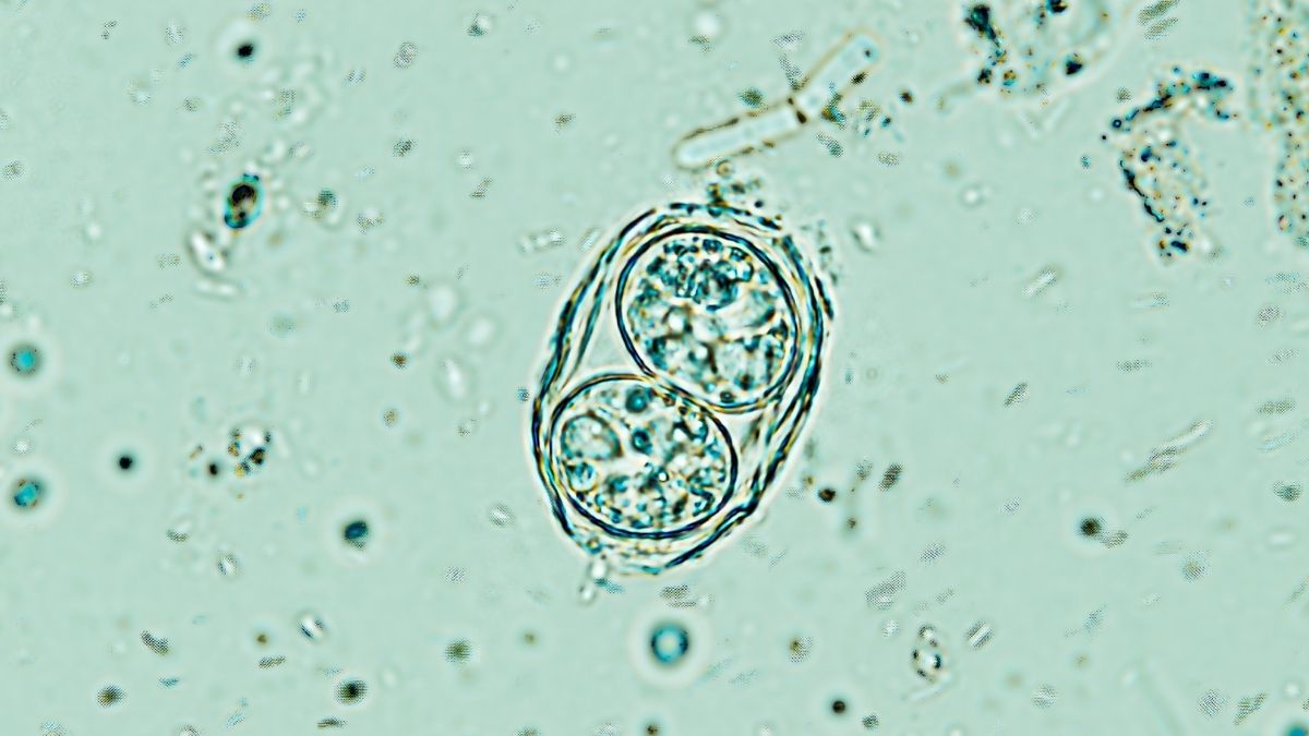 A brain parasite infecting millions is far less sleepy than we thought