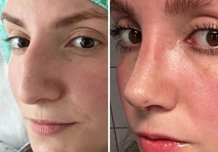38 striking before-and-after photos of plastic surgery that seriously ...