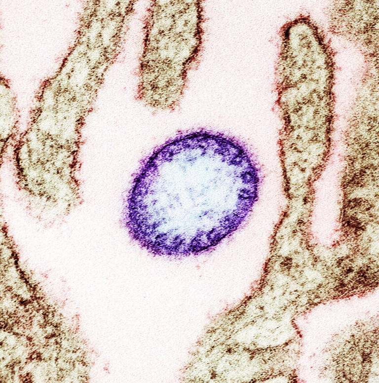Utbrudd av dødelig virus: Ber oss ta det med ro