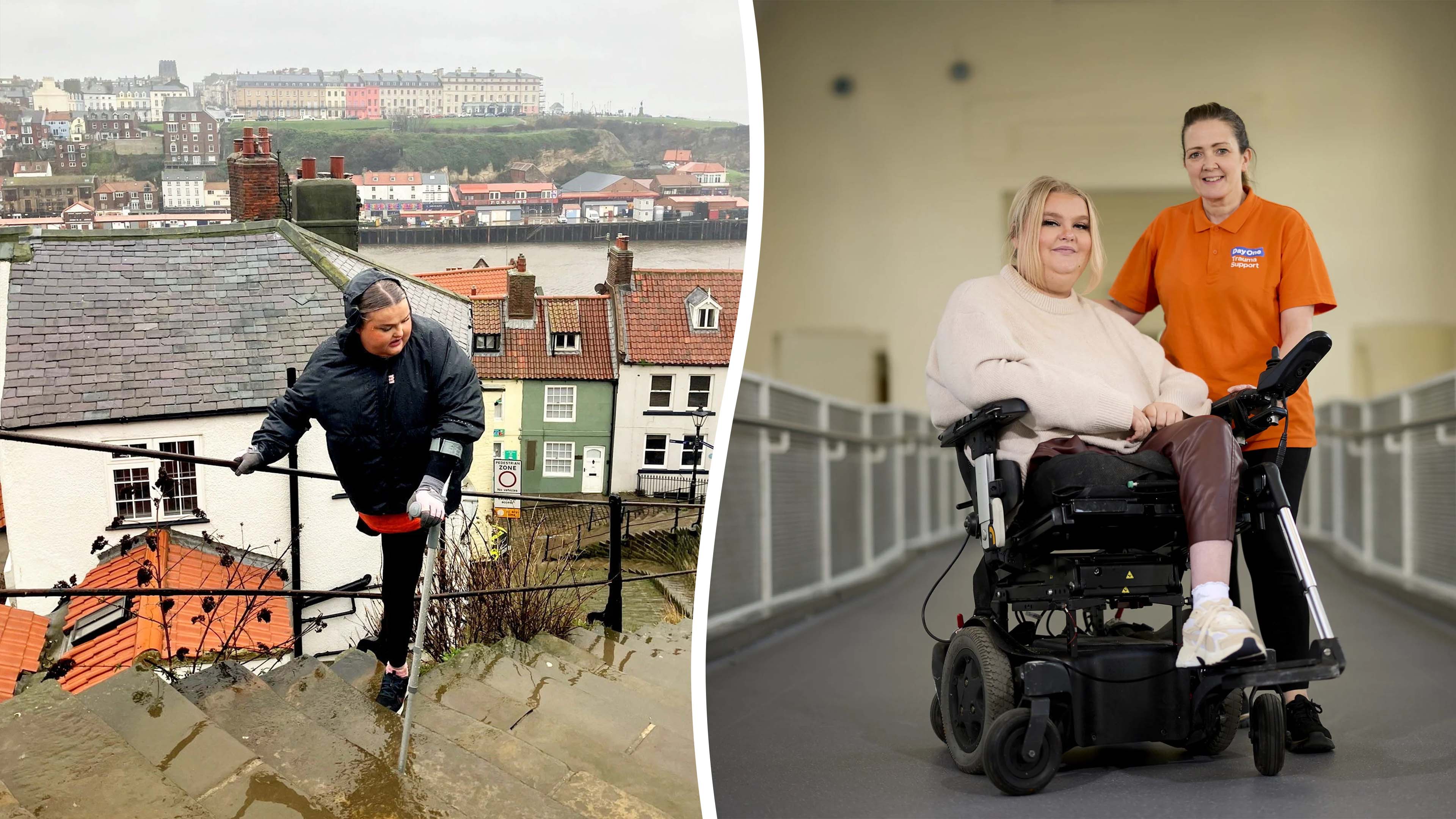 Woman with one leg after tractor accident hops up 200 steps to ...