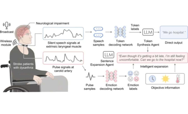 This new device lets patients speak again, without saying a word