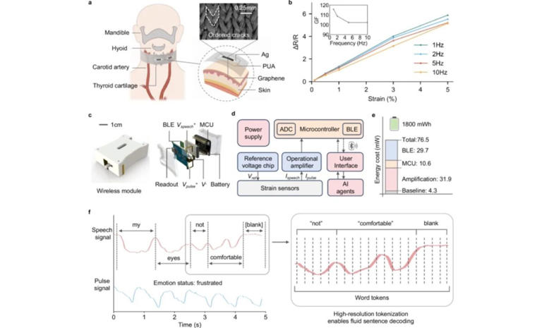 This new device lets patients speak again, without saying a word