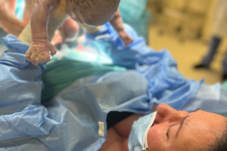 Mum lifted her own baby from womb in 'magical' Wishaw hospital C-section