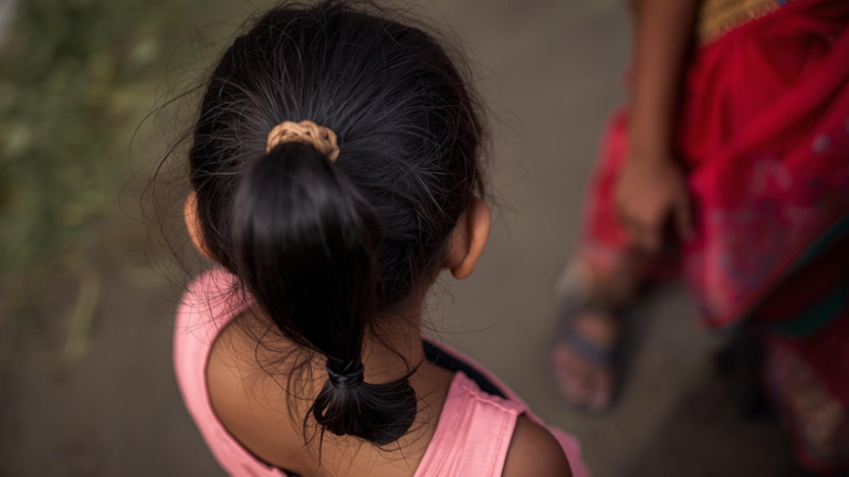 The story of brave Kolkata girl: She lived 912 days with her mouth open