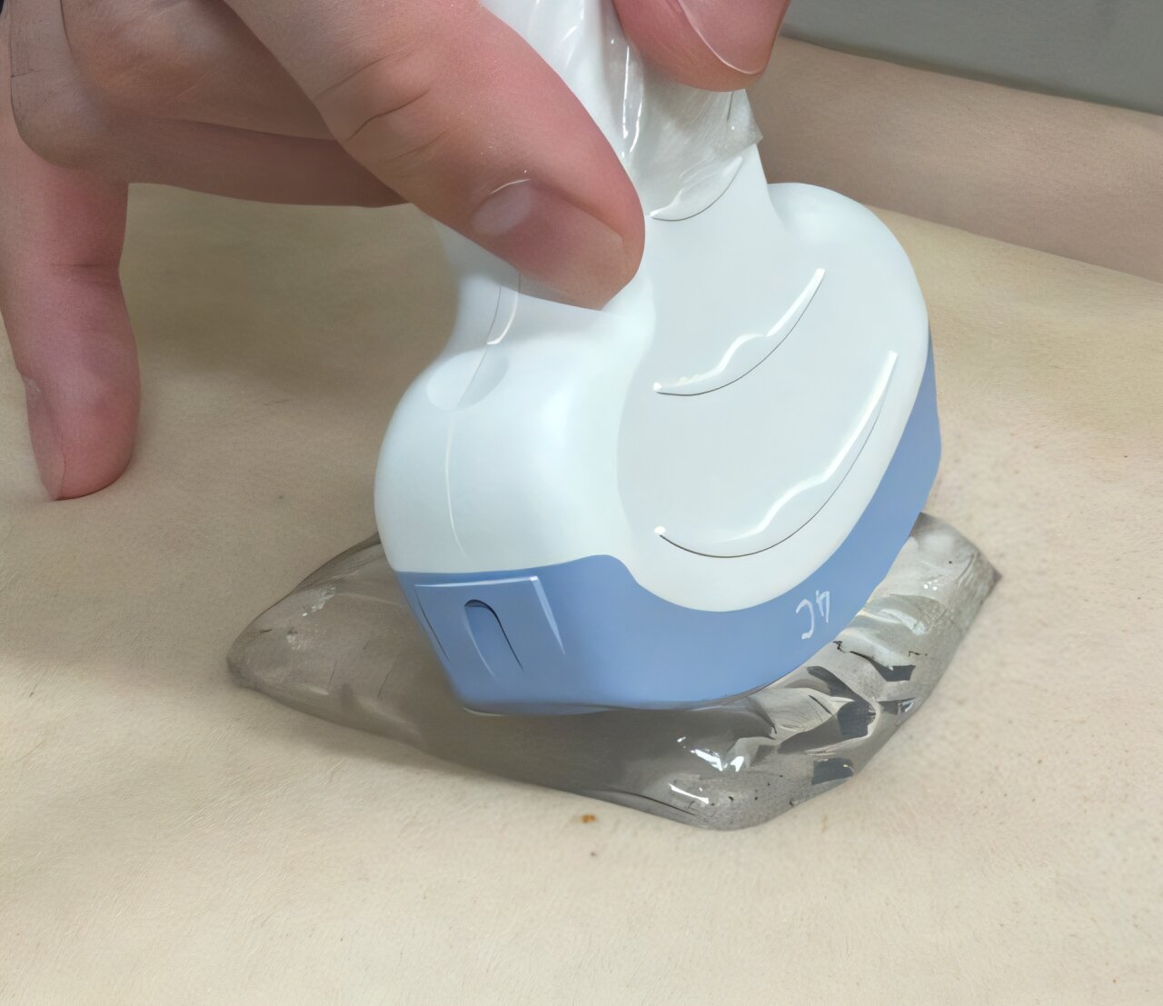 Rethinking ultrasound gel: A natural solid pad for clearer, more ...