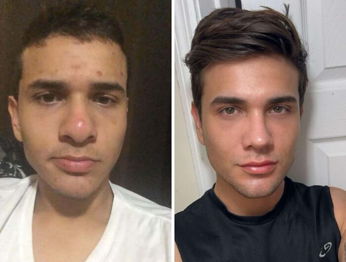 38 striking before-and-after photos of plastic surgery that seriously ...