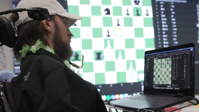 This shouldn’t be real: Paralysed patients play video games just by ...