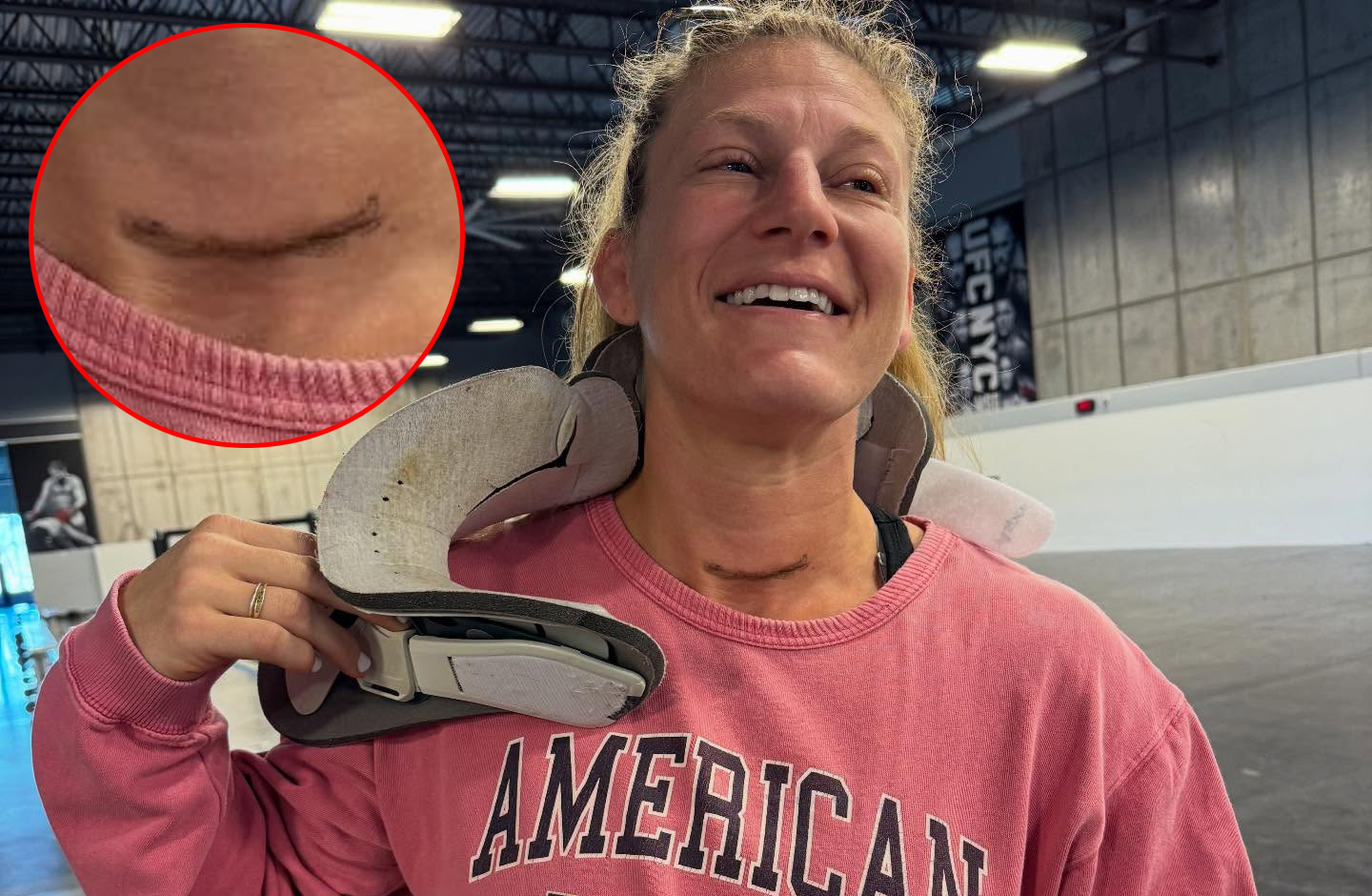 Pic: Kayla Harrison neck surgery leaves UFC champ with giant Franken-scar