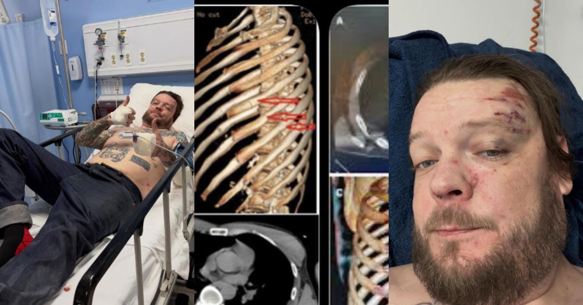 Motorcycle crash prevents Corey Harrison of ‘Pawn Stars’ fame from ...