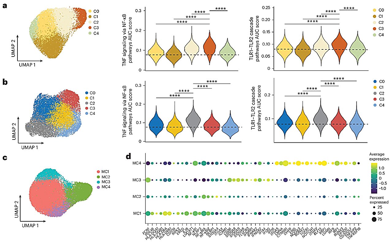How does long COVID develop? New piece of the puzzle found