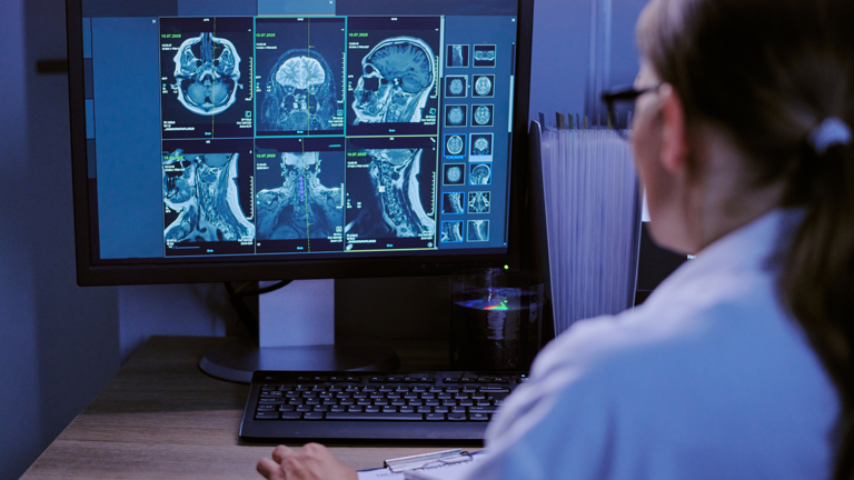 Astronauts came home with 'scrambled brains', and scientists say space ...