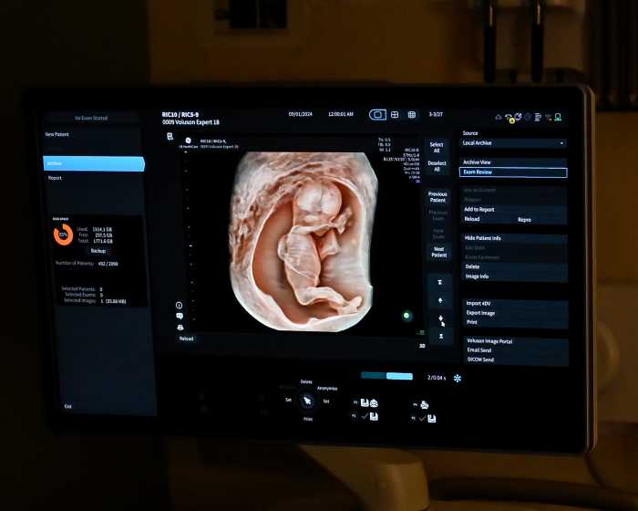 A new chapter in women’s health care: Maimonides celebrates grand ...