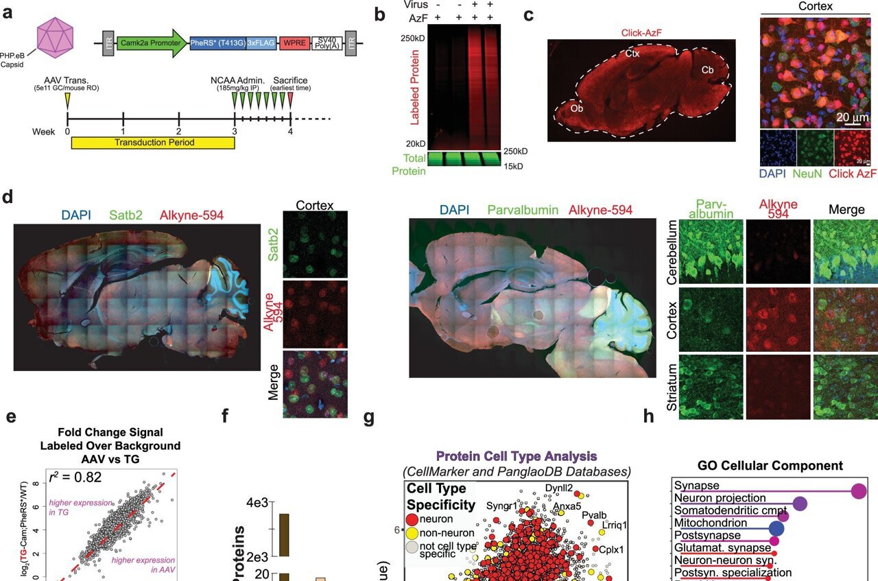 The brain's protein cleanup process may play a role in dementia