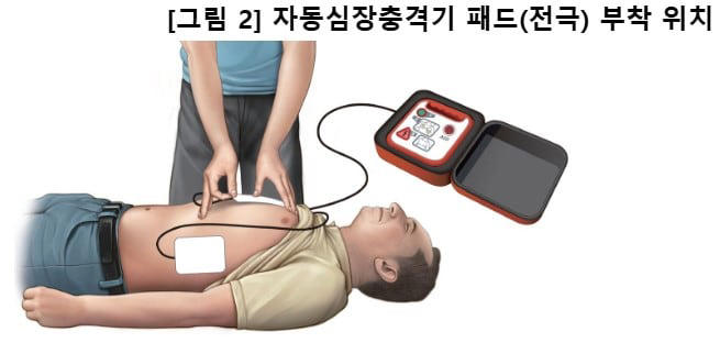 KDCA updates CPR guidelines: No bra removal for female patients