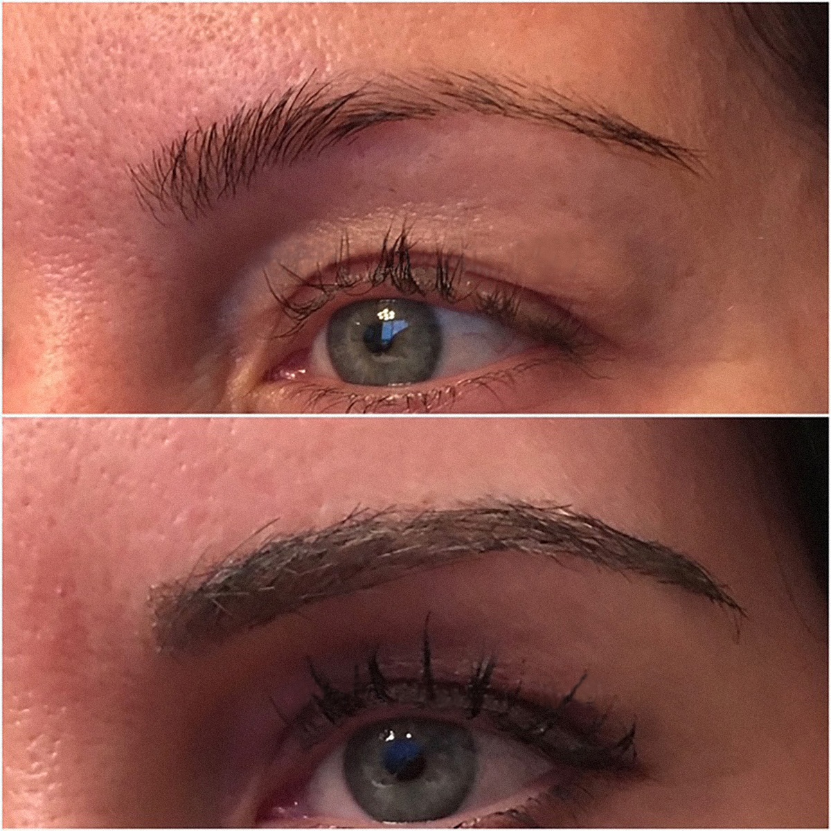 Would you pay $18,000 for new eyebrows?
