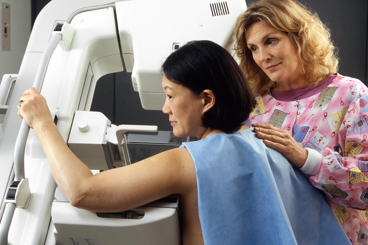 Experts uncover way to identify patients with high breast cancer risk