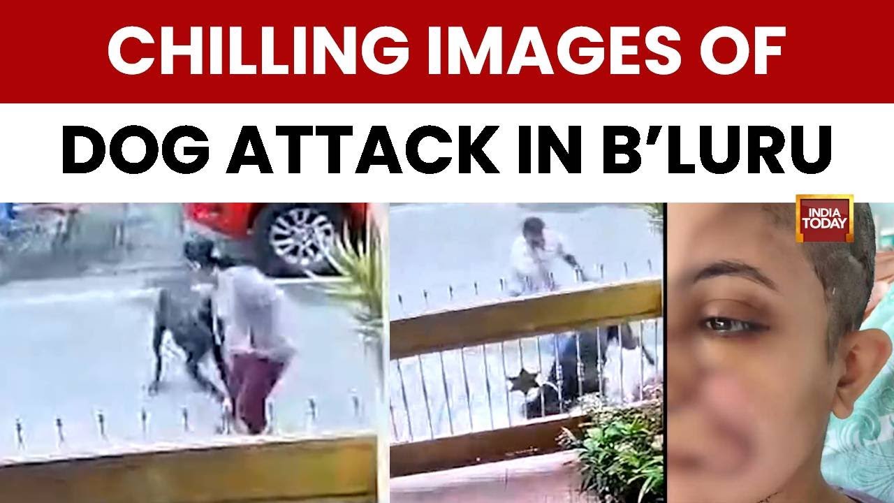 Bengaluru Dog Attack: Pet Dog Attacks Woman, Victim Receives 50 ...