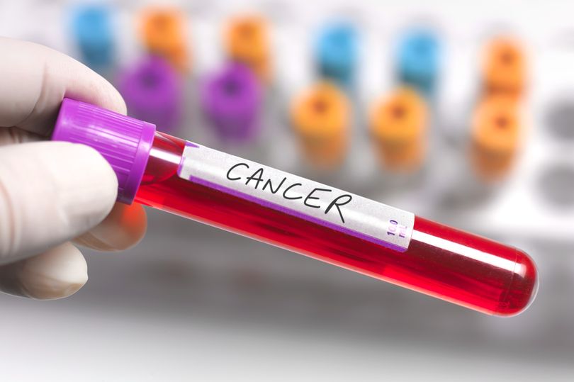 Cancer dietitian names 2 foods that should be completely omitted to cut ...