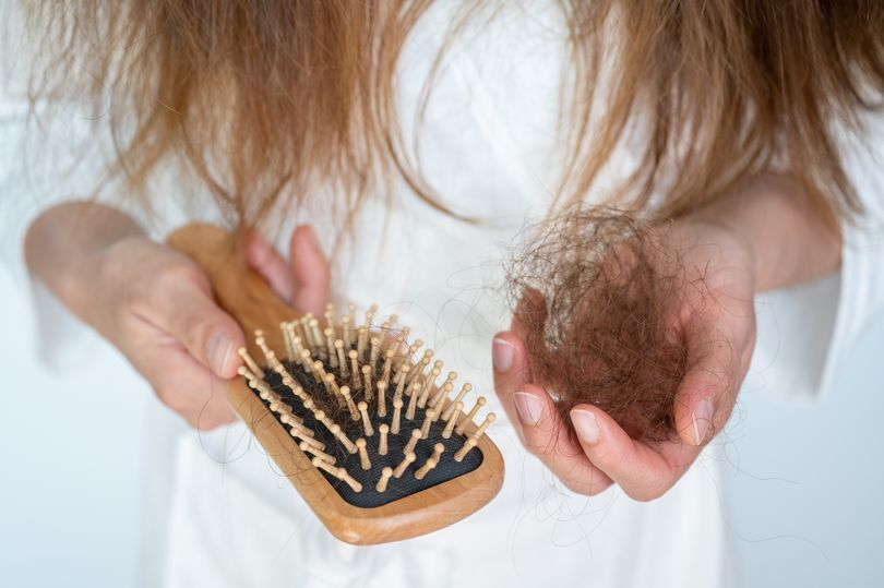 Hair loss warning for anyone stopping weight-loss jabs