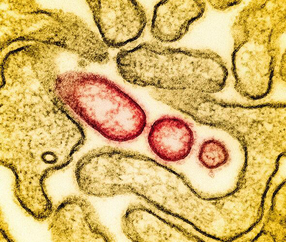 WHO issues major travel update over brain-swelling virus after India ...