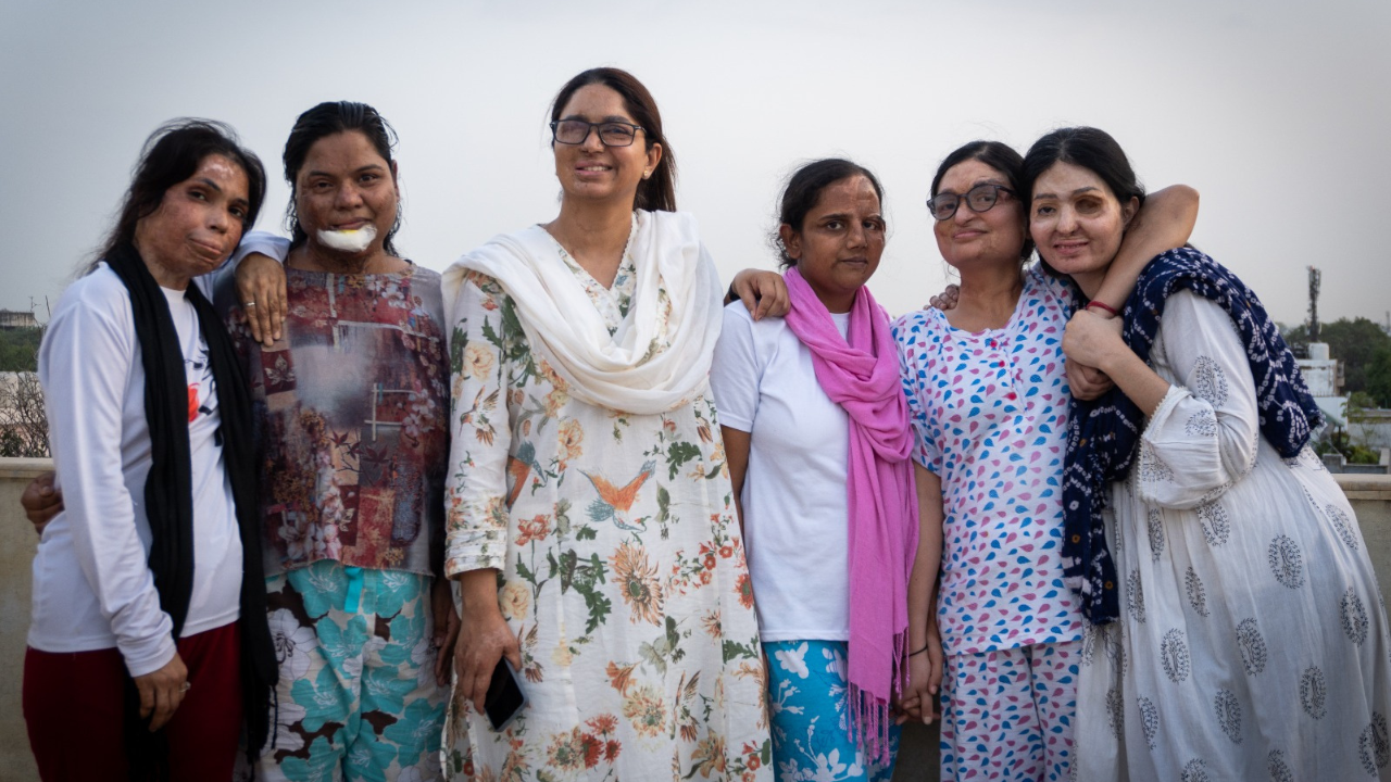 Have to live with scars for life but will fight on: Acid attack ...