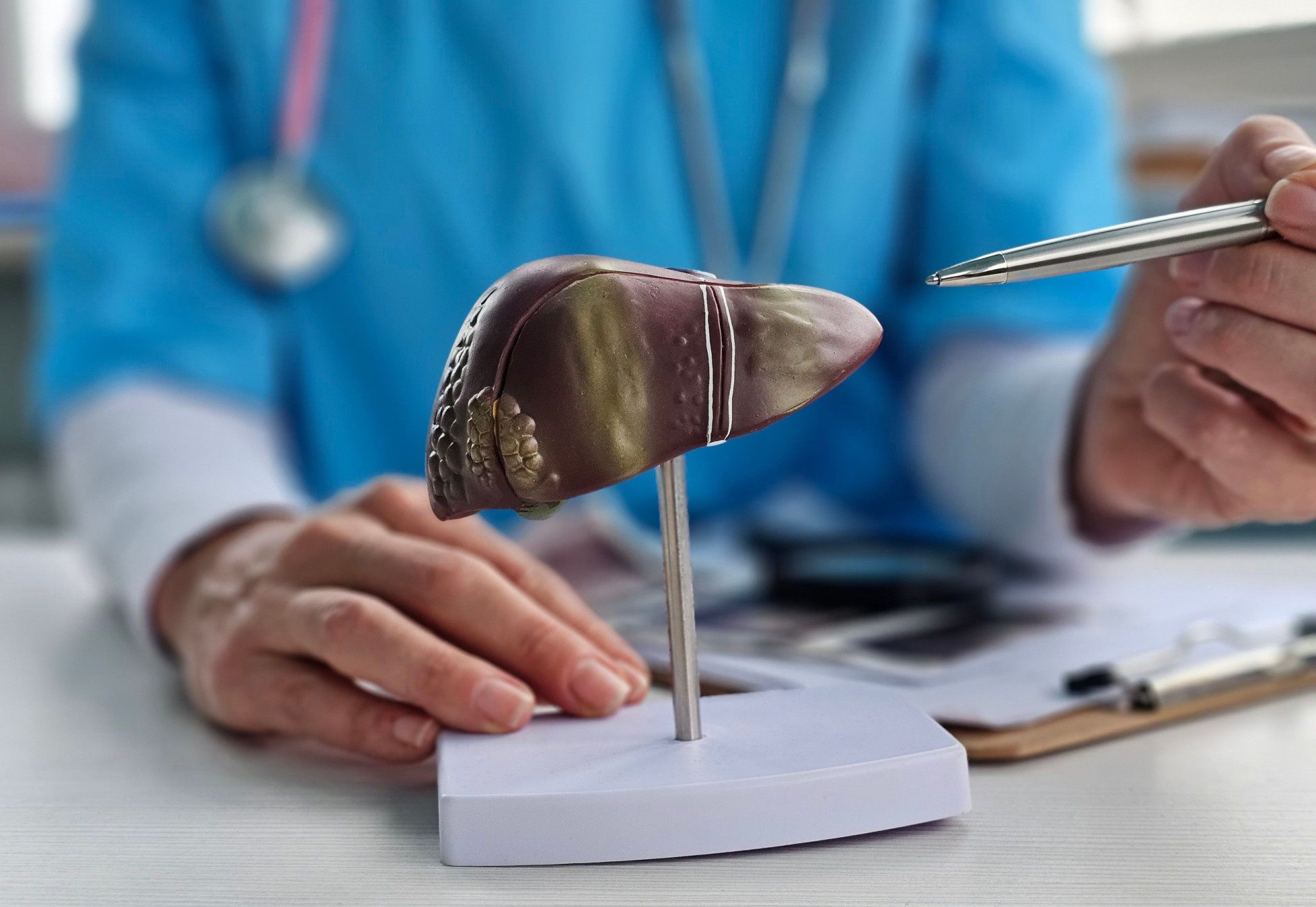 Famous people who suffered from cirrhosis